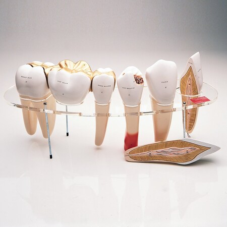 Denoyer-Geppert Anatomical Model, Dental Morphology Series 0114-00 | Zoro