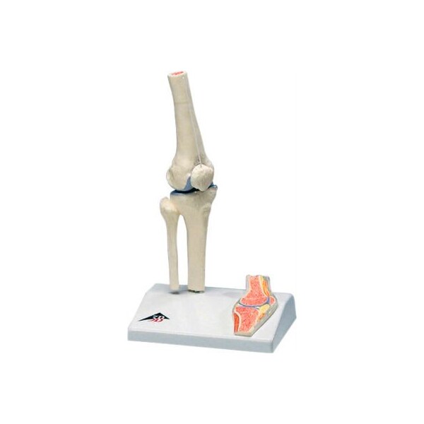Fabrication Enterprises 3B Anatomical Model - Mini Knee Joint with ...