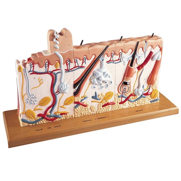 Denoyer-Geppert Anatomical Model, Skin with Burn Pathology 0185-00 | Zoro